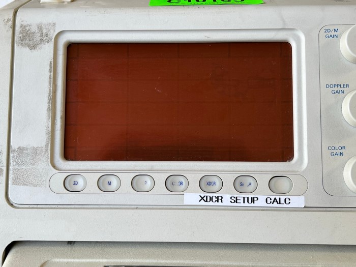 Advanced Technology Lab Ultramark 9 Ultrasound System for sale