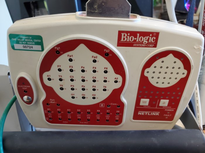 Biologic Sleep Scan Cart for sale