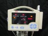 Casmed 740 Vital Signs Monitor With Stand for sale