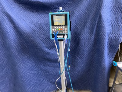 Critikon Dinamap plus Vital Signs Monitor ECG for sale