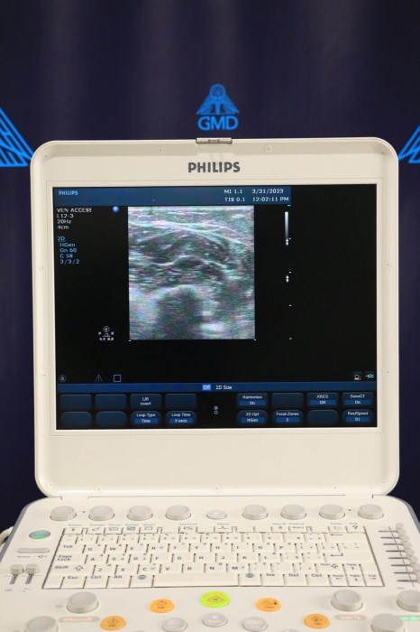 PHILIPS CX-50 PORTABLE ULTRASOUND SYSTEM for sale