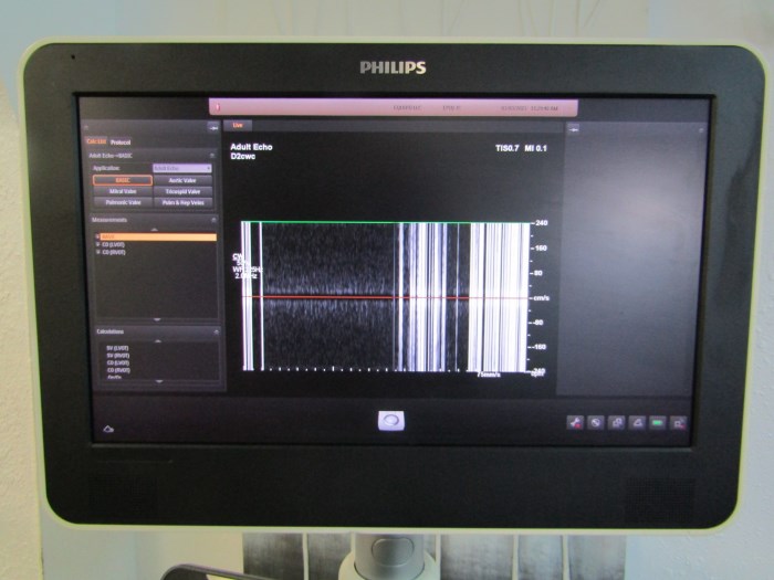 Philips EPIQ 7C (Cardiac) Ultrasound Machine for sale