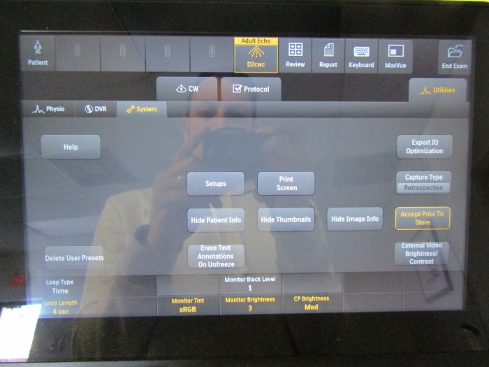 Philips EPIQ 7C (Cardiac) Ultrasound Machine for sale