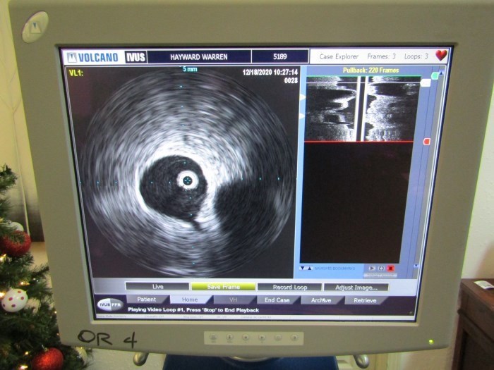 VOLCANO CORP S5 Imaging System for sale